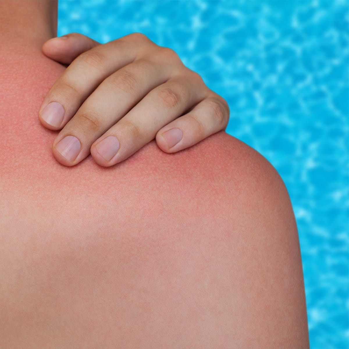 Eye and Skin Irritation After Swimming – HTH-Ca